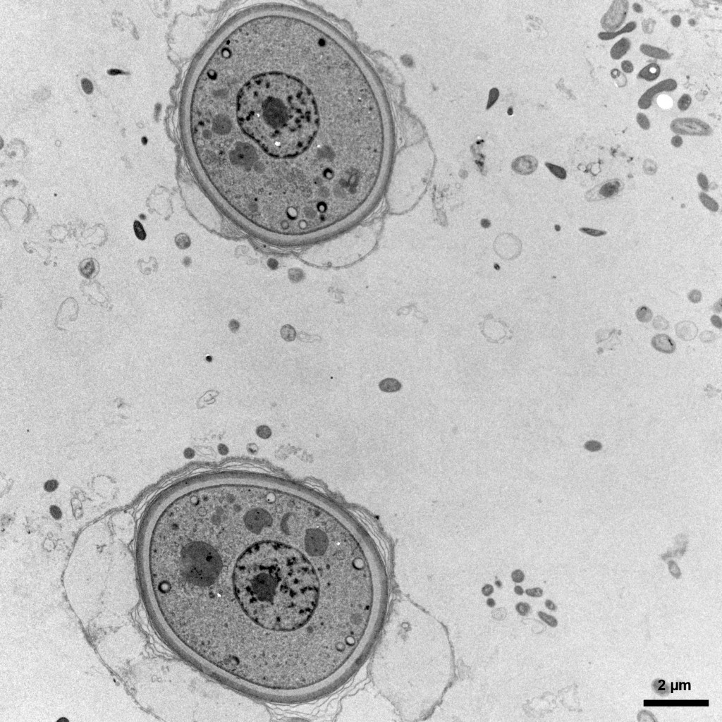 TEM Images | Bioscience Electron Microscopy Laboratory | Physiology and ...