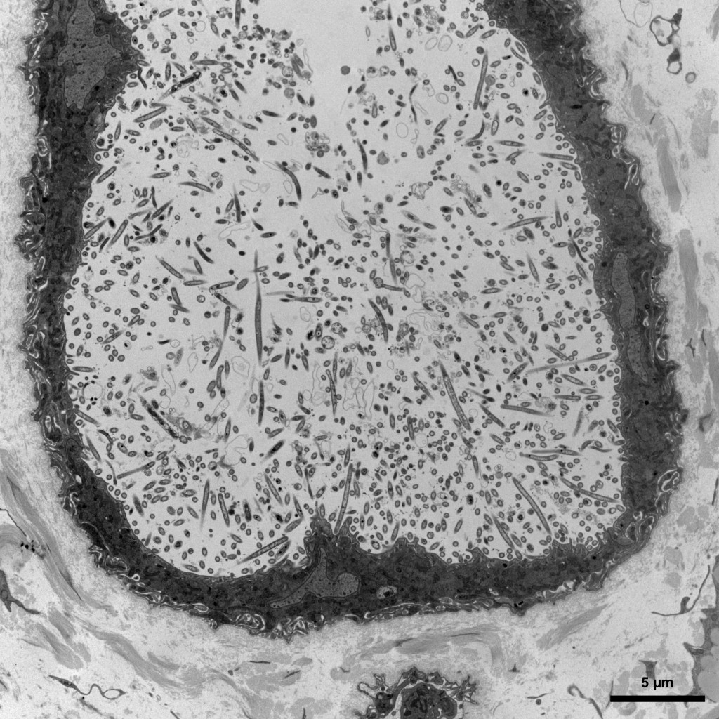 TEM Images | Bioscience Electron Microscopy Laboratory