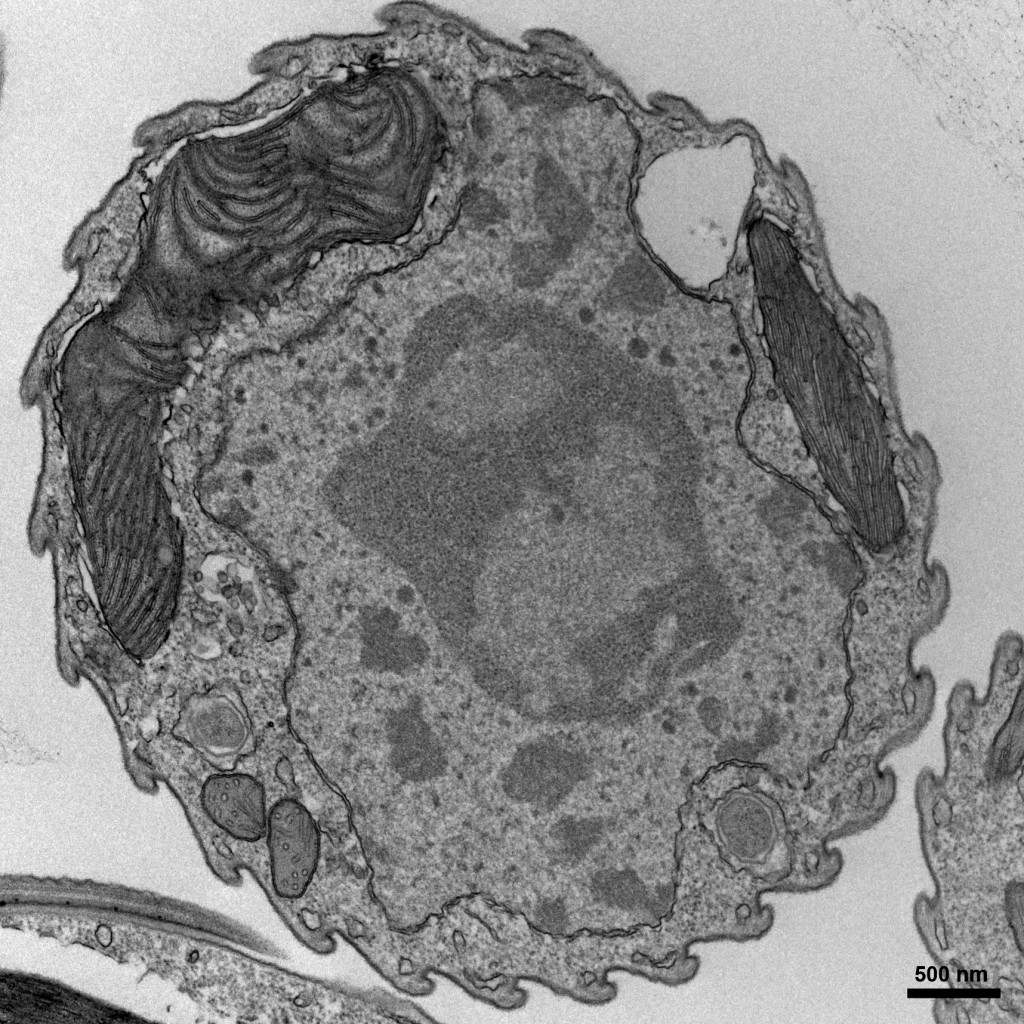 TEM Images | Bioscience Electron Microscopy Laboratory | Physiology and ...